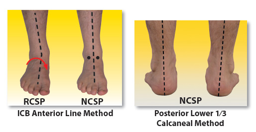 August, 2013 | DLT Podiatry
