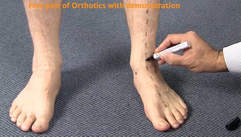 ICB Orthotic demonstration | DLT Podiatry