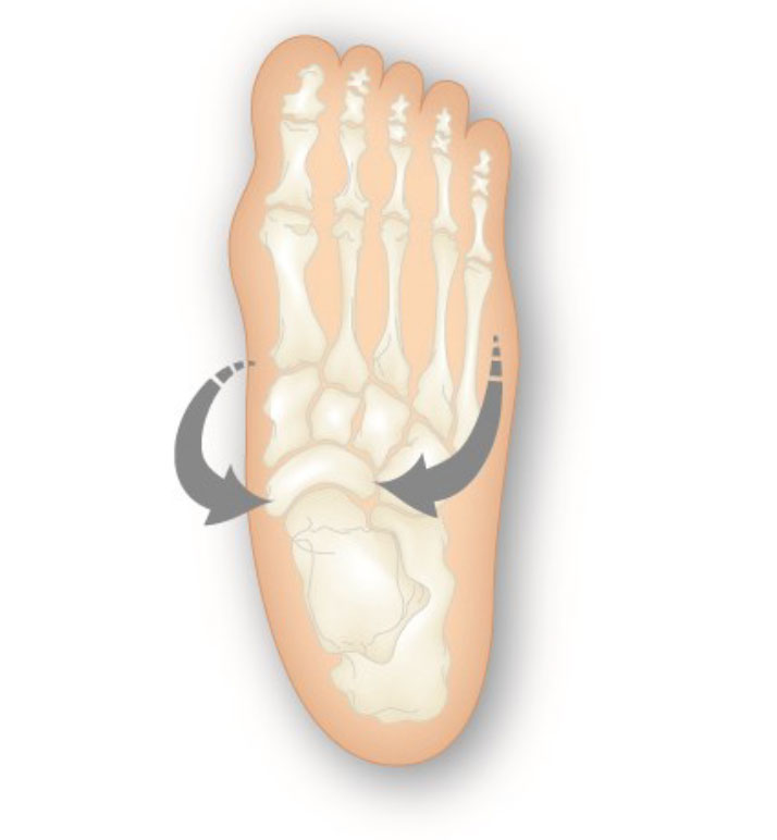 Orthotics The ICB Anterior Alignment Method | DLT Podiatry
