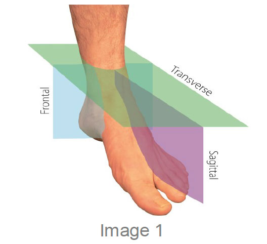 Dorsiflexed 1st Metatarsal | DLT Podiatry