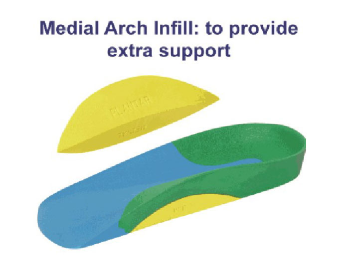 Arch Pain When Wearing Orthotics | DLT Podiatry