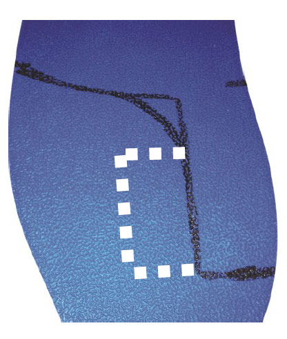 Modifying Orthotics | DLT Podiatry