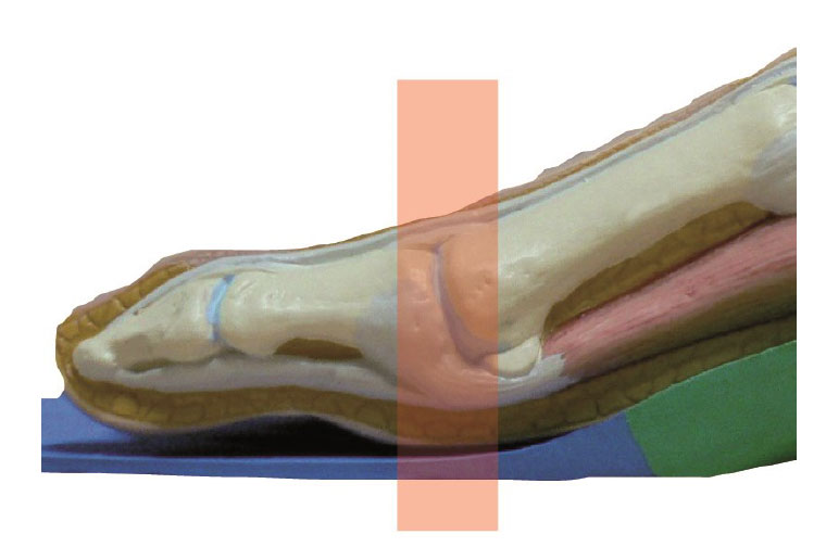 August, 2019 | DLT Podiatry