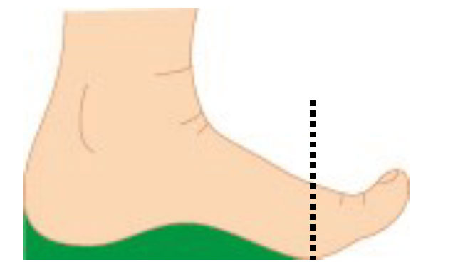 August, 2019 | DLT Podiatry