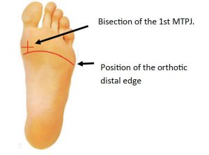 Using Orthotics for Metatarsal Pain | DLT Podiatry