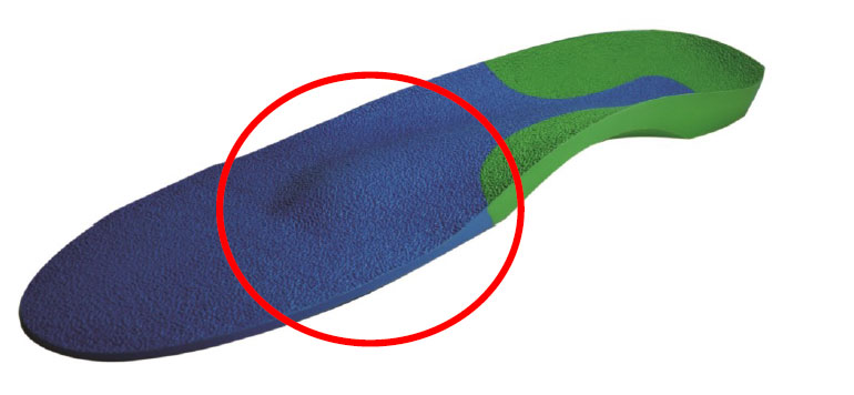 Using Orthotics for Metatarsal Pain | DLT Podiatry