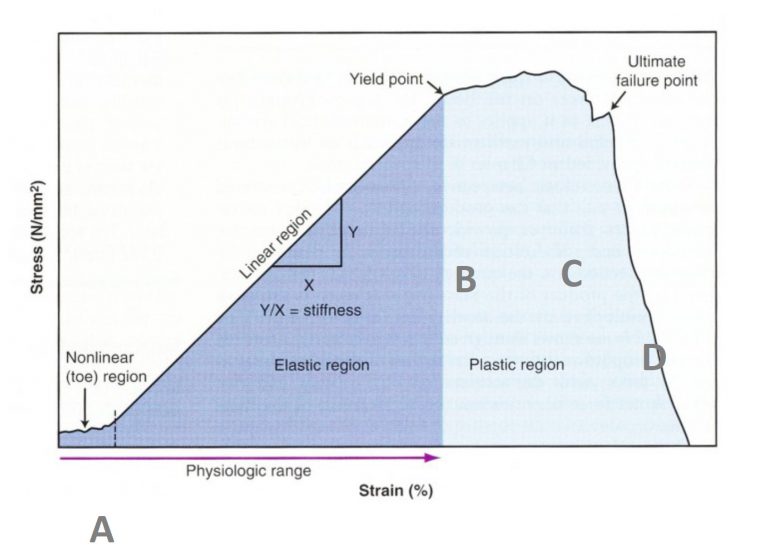 Treatment with Orthotics for Achilles Pain | DLT Podiatry